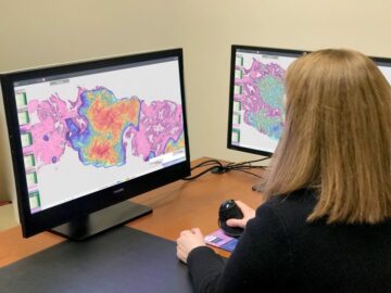 Ibex Partners with Alverno Labs to Enhance U.S. Roll Out of AI Cancer ...